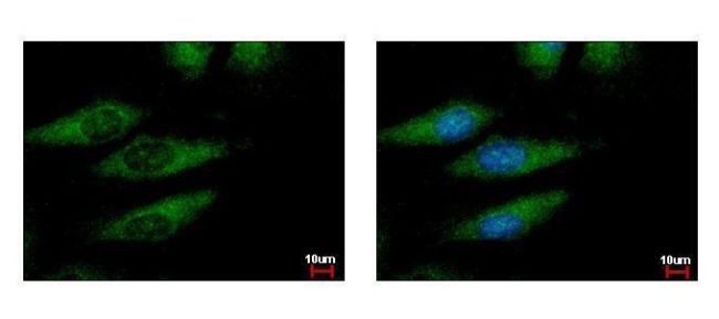 IBA1 Antibody (PA5-27436)