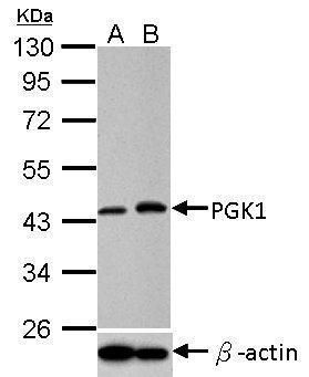 PGK1 Antibody (PA5-28612)