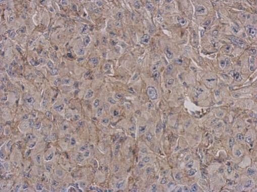 CD180 Antibody (PA5-28934)