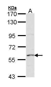 ASB2 Antibody (PA5-29476)