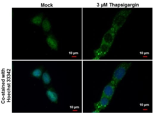 LC3B Antibody (PA5-30598)