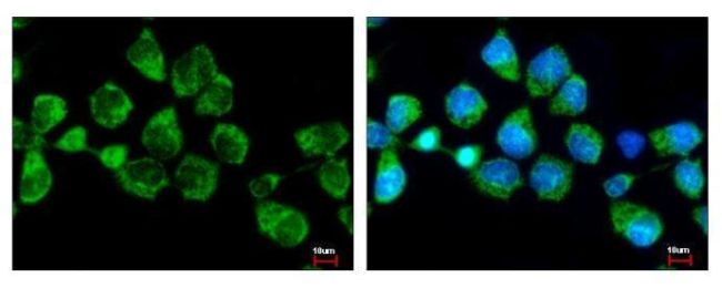 SNX5 Antibody (PA5-31206)