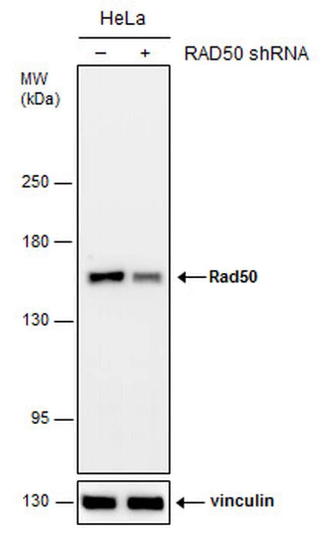 RAD50 Antibody (PA5-31554)