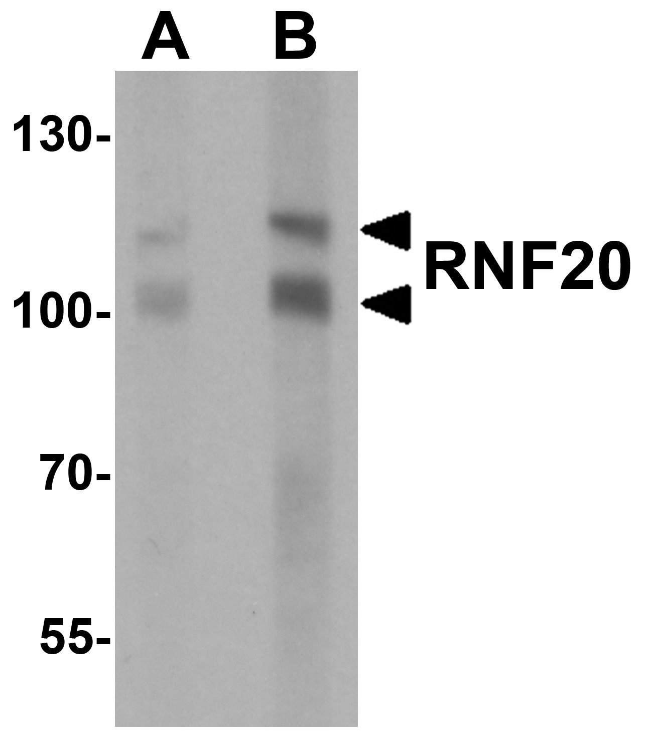 RNF20 Antibody (PA5-34552)
