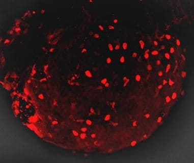 mCherry Antibody (PA5-34974)