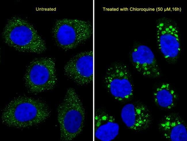 LC3B Antibody (PA5-35195)