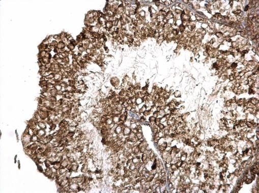 ITGB6 Antibody (PA5-35903)