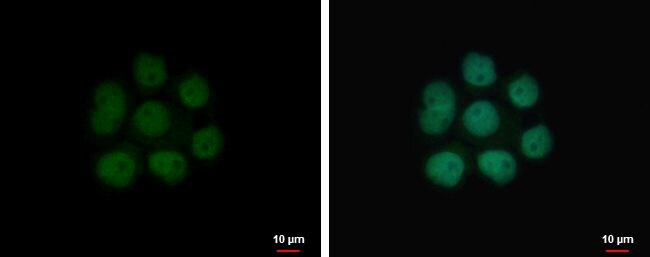 NFIA Antibody (PA5-35936)
