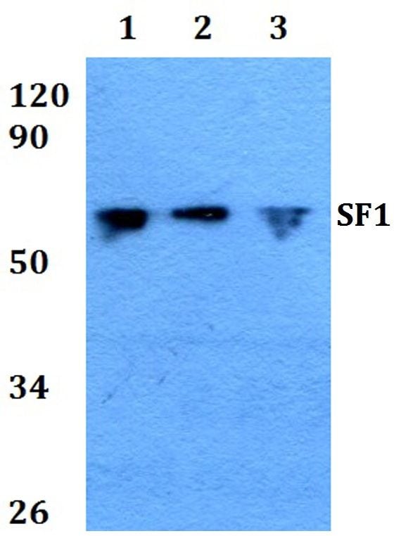 SF1 Antibody (PA5-36103)