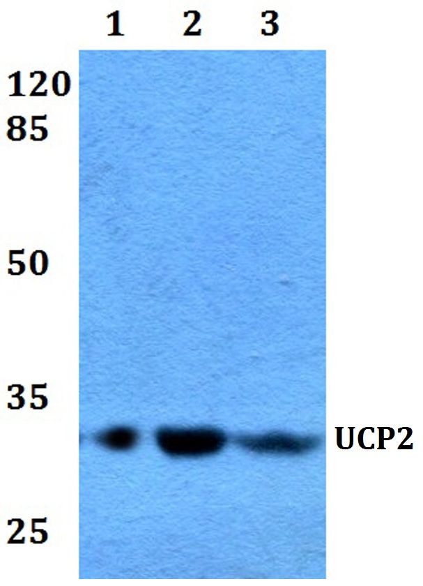 UCP2 Antibody (PA5-36383)
