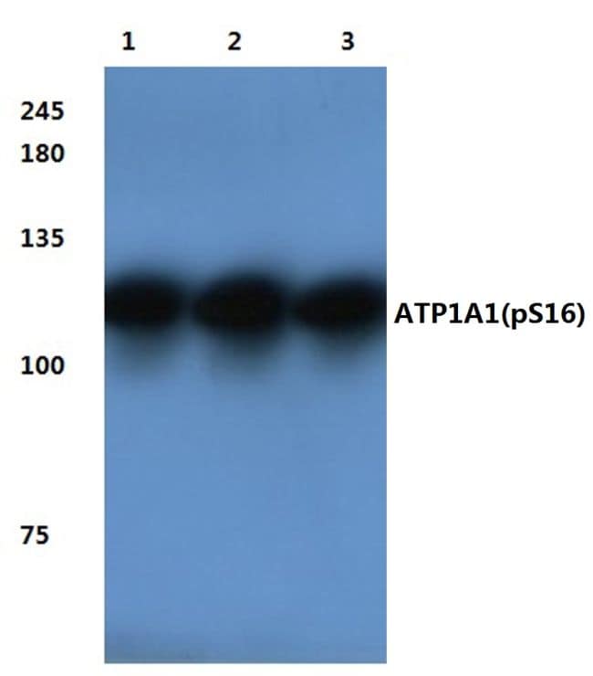 Phospho-ATP1A1 (Ser16) Antibody (PA5-36732)