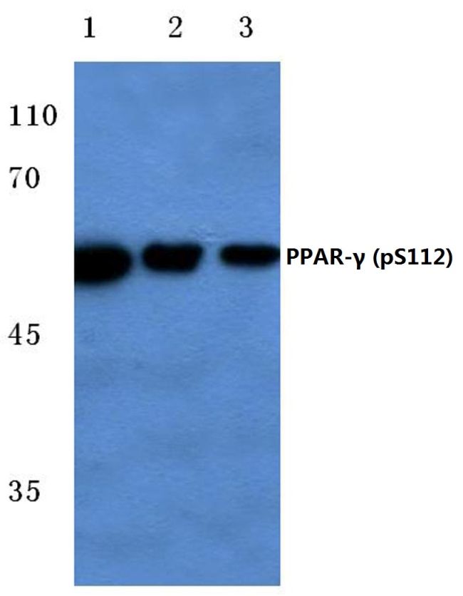 Phospho-PPAR gamma (Ser112) Antibody (PA5-36763)