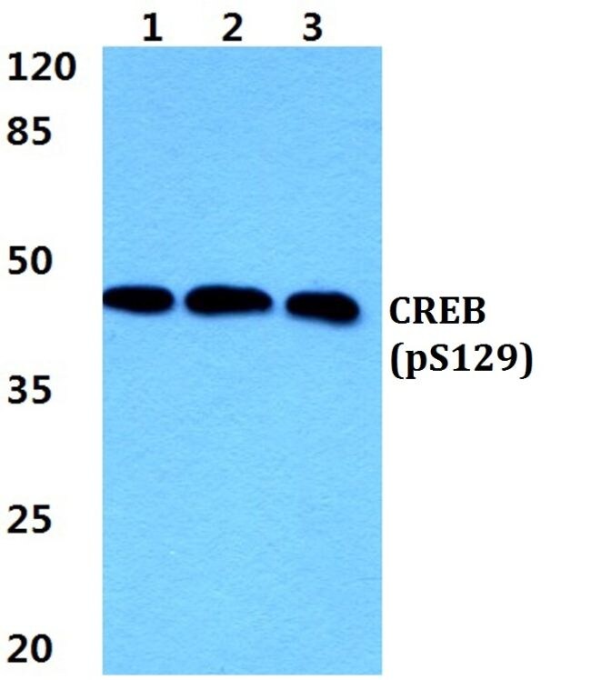 Phospho-CREB (Ser129) Antibody (PA5-36843)