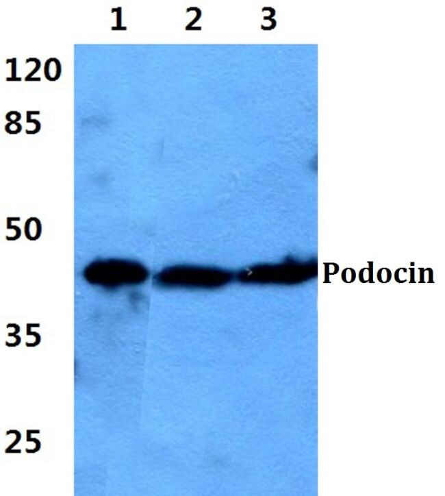 Podocin Antibody (PA5-37284)