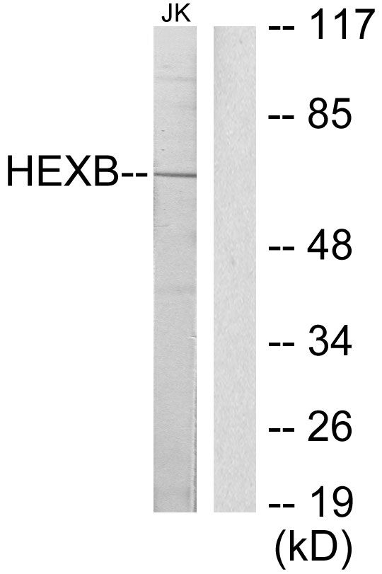 HEXB Antibody (PA5-38571)