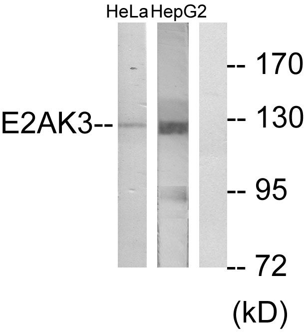PERK Antibody (PA5-38811)