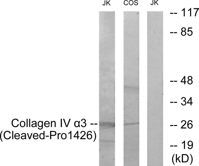 COL4A3 (Cleaved Pro1426) Antibody (PA5-39877)