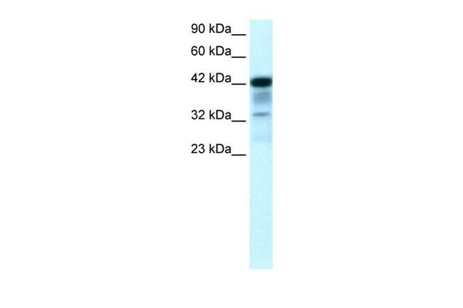 PLA1 Antibody (PA5-40556)