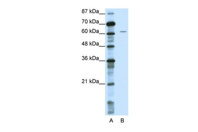 NOTCH4 Antibody (PA5-40587)