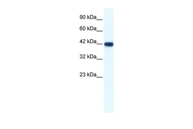 IBSP Antibody (PA5-41327)