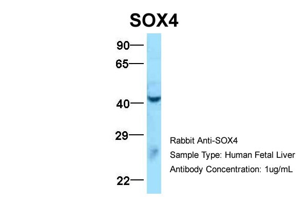 SOX4 Antibody (PA5-41442)