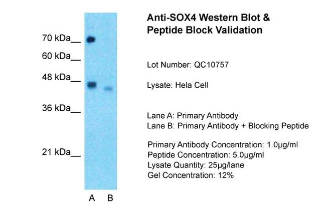 SOX4 Antibody (PA5-41442)
