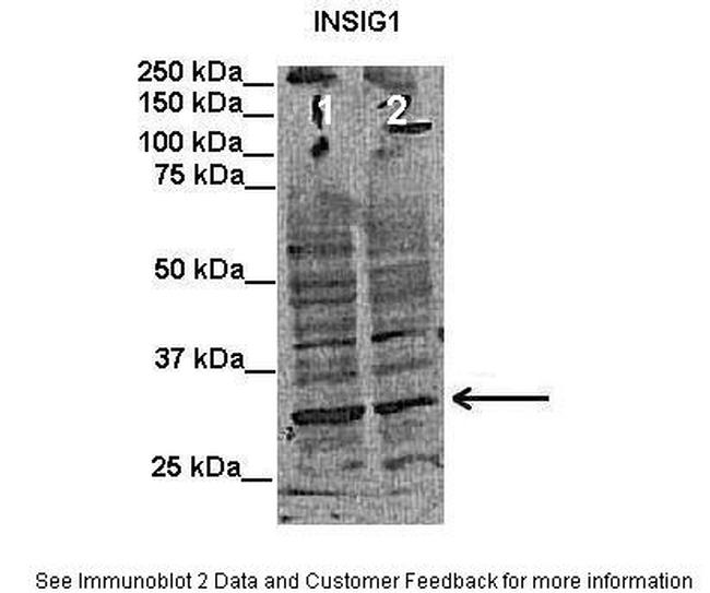 INSIG1 Antibody (PA5-41706)