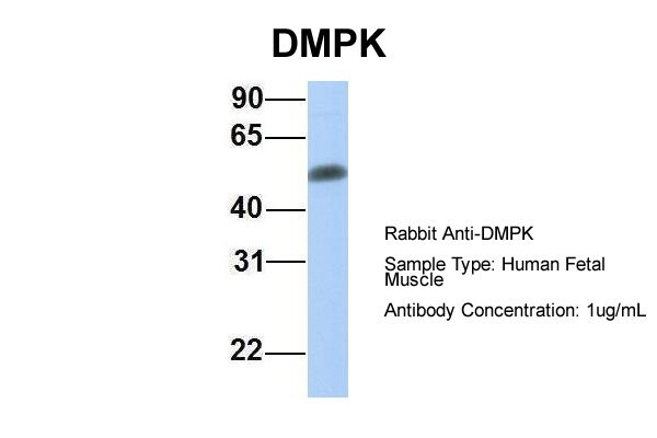 DMPK Antibody (PA5-42121)
