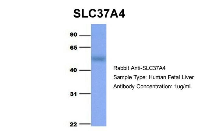SLC37A4 Antibody (PA5-42423)