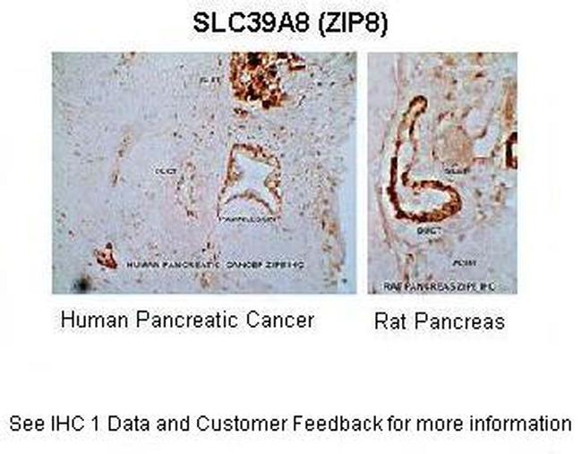 SLC39A8 Antibody (PA5-42489)