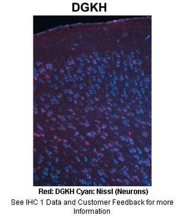 DGKH Antibody (PA5-42769)