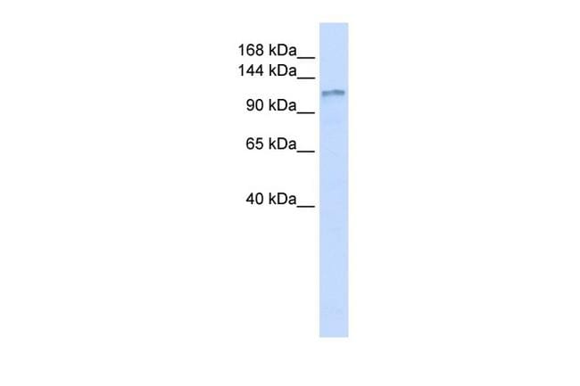 DGKH Antibody (PA5-42769)