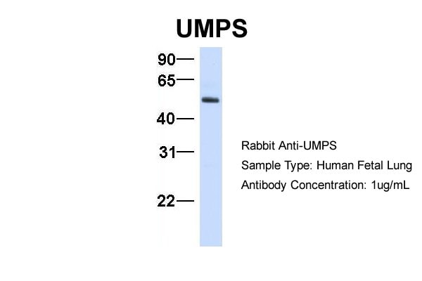 UMPS Antibody (PA5-43134)