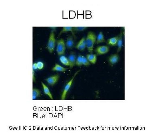 LDHB Antibody (PA5-43141)