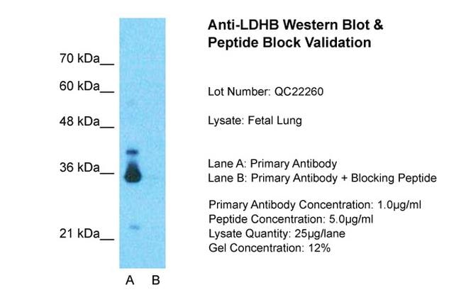LDHB Antibody (PA5-43141)