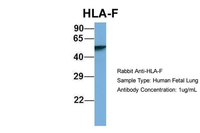 HLA-F Antibody (PA5-43345)