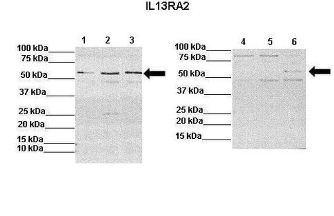 IL13RA2 Antibody (PA5-44066)