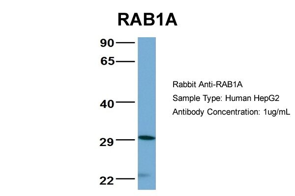 RAB1A Antibody (PA5-44578)