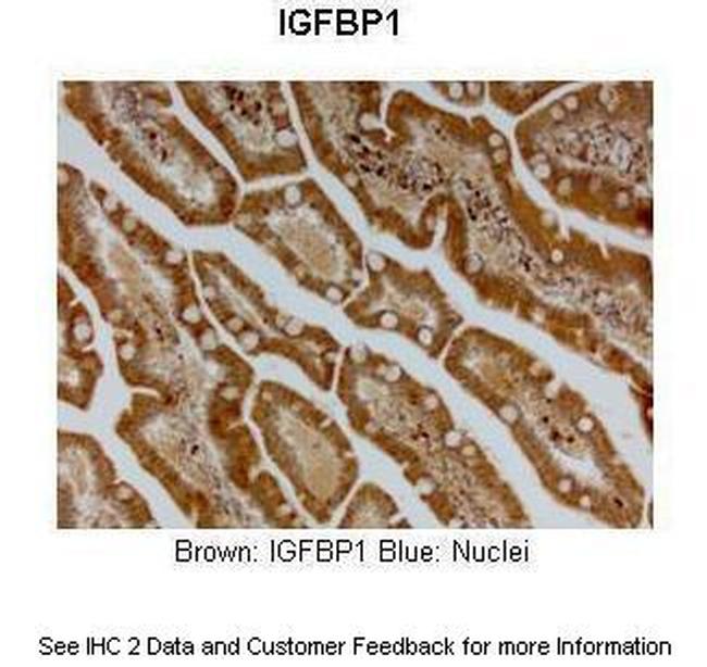 IGF2BP1 Antibody (PA5-44886)