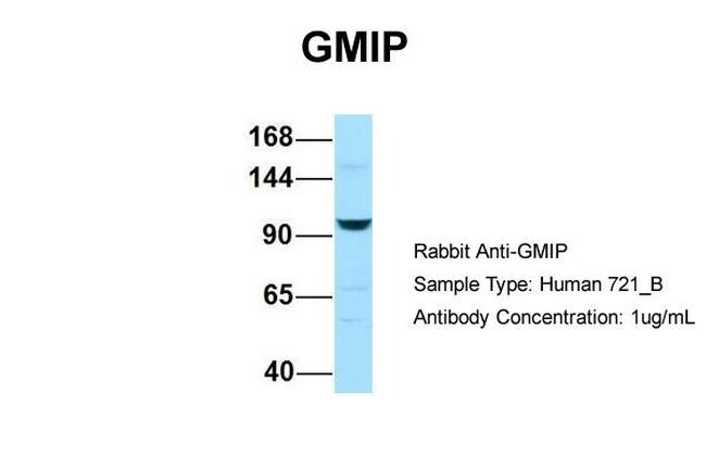 GMIP Antibody (PA5-45745)