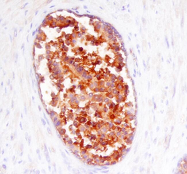 Prostasin Antibody (PA5-46953)