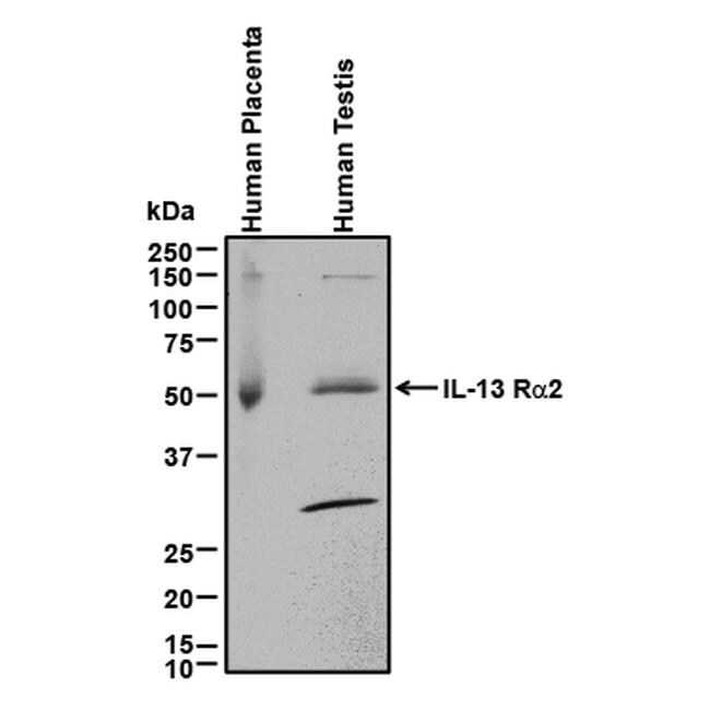 IL13RA2 Antibody (PA5-46976)