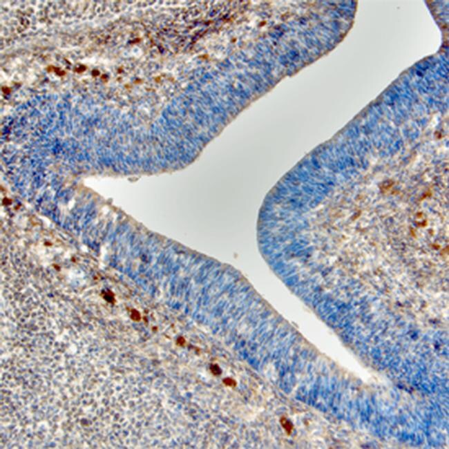 SEMA3C Antibody (PA5-47189)
