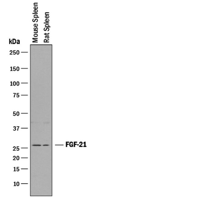 FGF21 Antibody (PA5-47438)