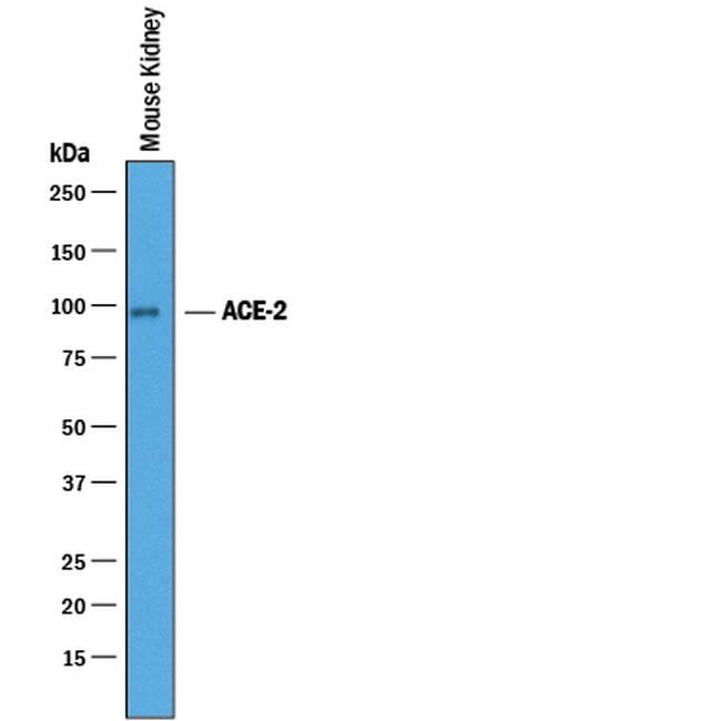 ACE2 Antibody (PA5-47488)