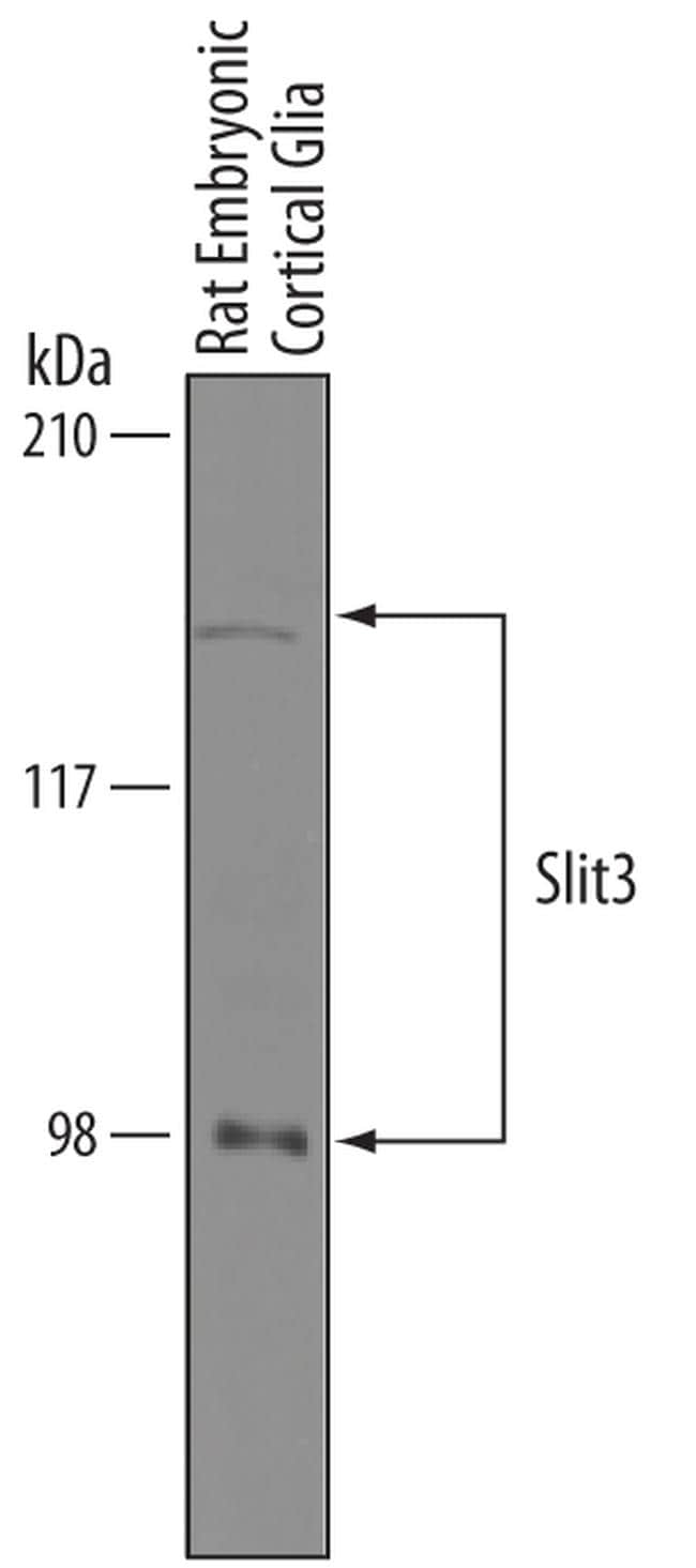 SLIT3 Antibody (PA5-47519)