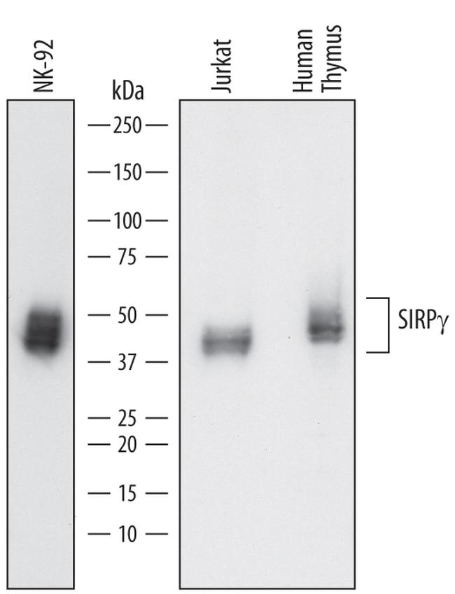 SIRP gamma Antibody (PA5-47627)