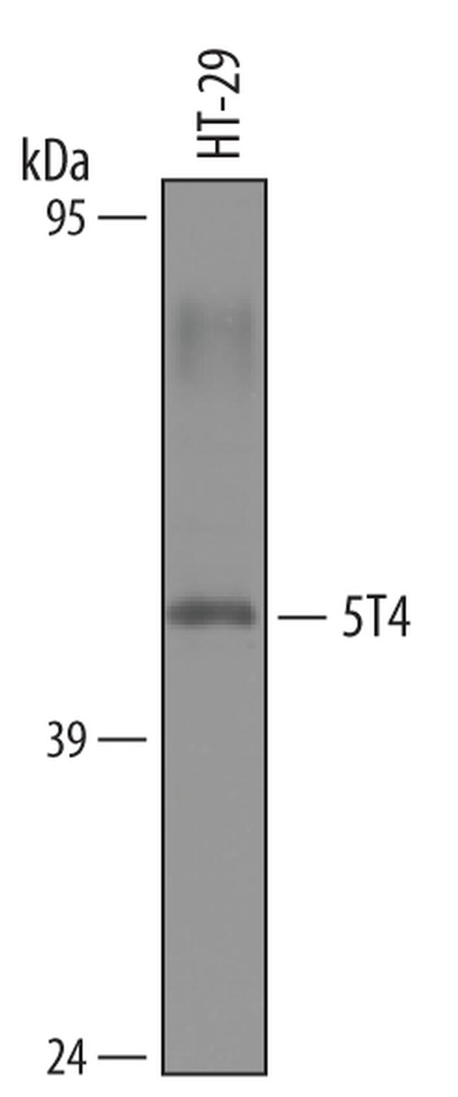 5T4 Antibody (PA5-47679)
