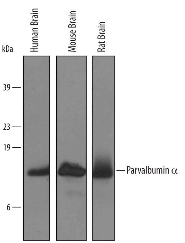Parvalbumin Antibody (PA5-47693)