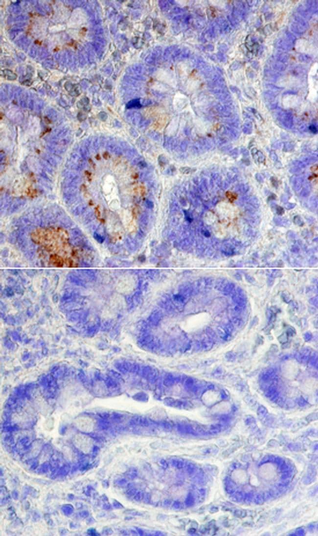 ASCL2 Antibody (PA5-47852)